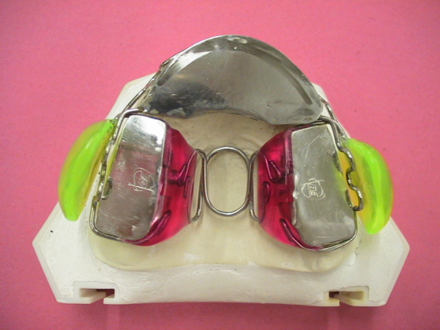 Marangione Ortodonzia